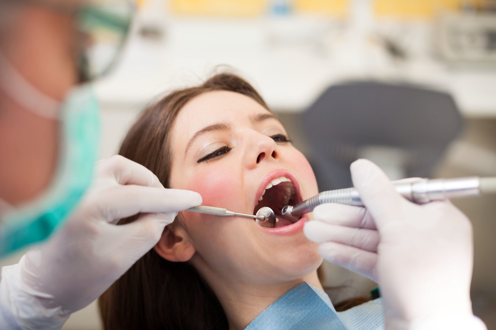Dental Sealants in Buckhead | Ponce Dental